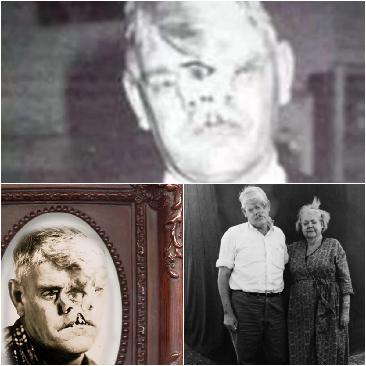 The Tragic Life of the Man with Three Eyes, Two Noses, and a Split Face ...