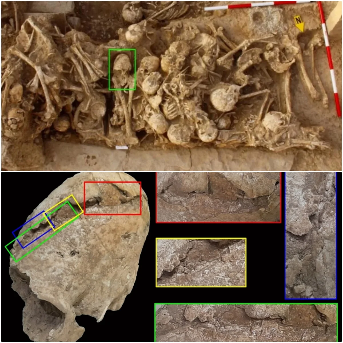 Cone-Headed Skull of 6,200-Year-Old Girl Unearthed in Iran, Scientists ...